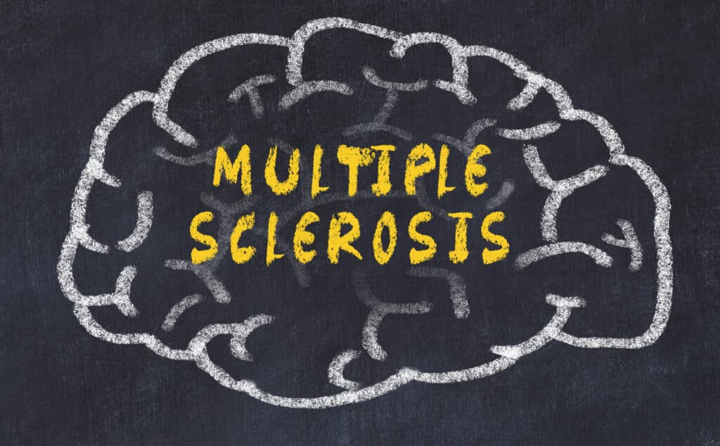 Four Diagnostics And Treatments Of MS Today | Atlanta Neuroscience ...